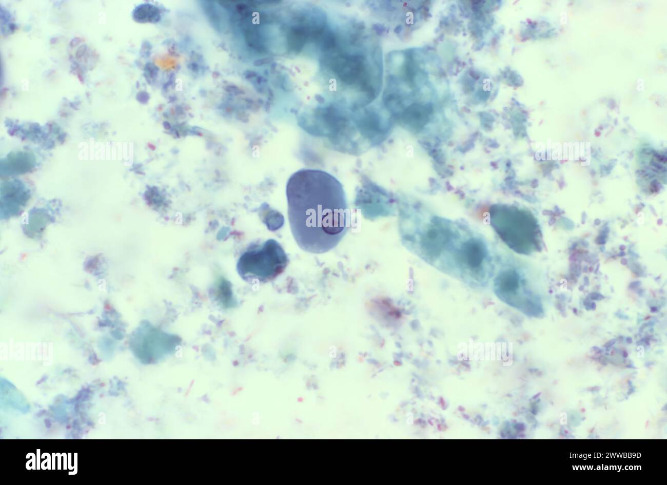 This trichrome-stained photomicrograph revealed some of the ...
