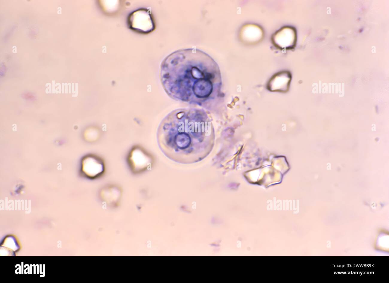Using a methylene blue staining technique, this photomicrograph ...
