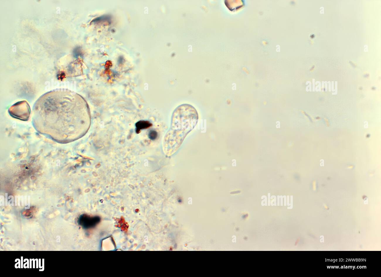 Entamoeba moshkovskii hi-res stock photography and images - Alamy