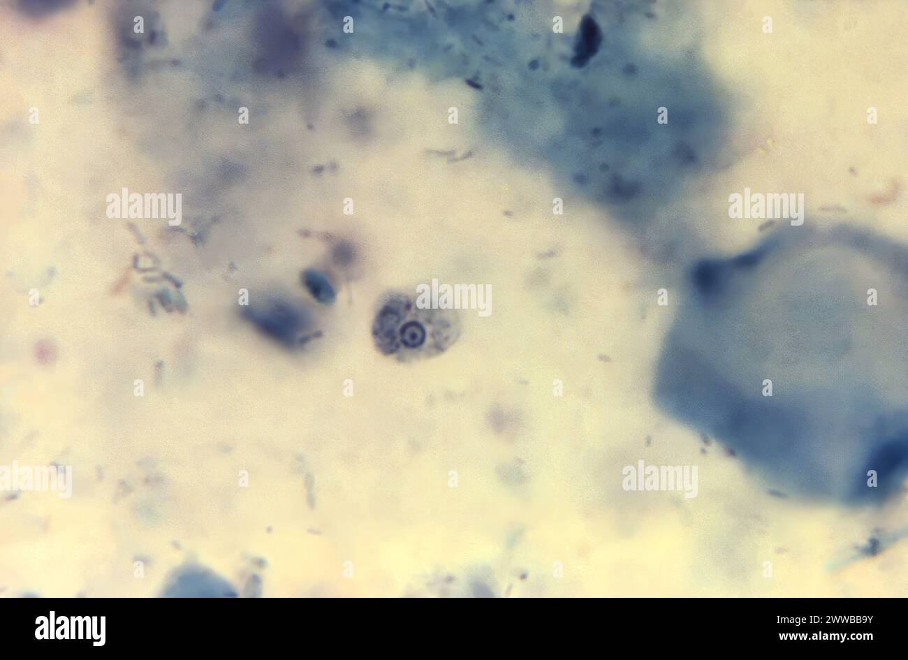 Under 1187.5X magnification, this photomicrograph of a trichrome ...