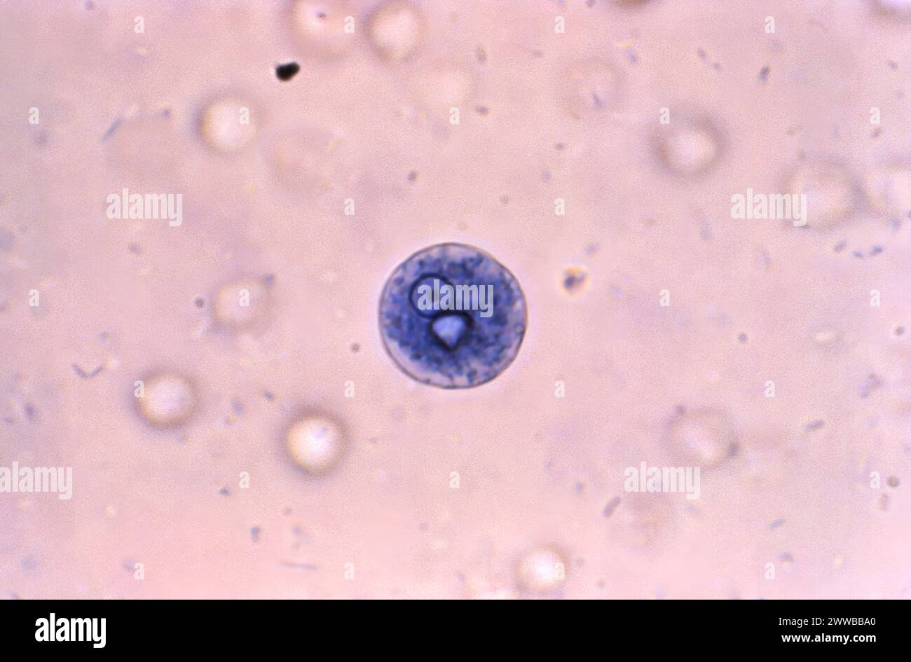 Blue staining technique hi-res stock photography and images - Alamy