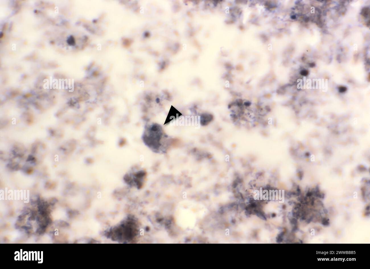 Using an iron-hematoxylin staining method, this photomicrograph reveals ...
