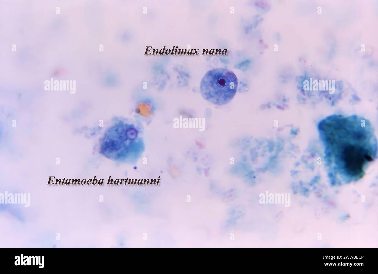 Endolimax Nana Cyst