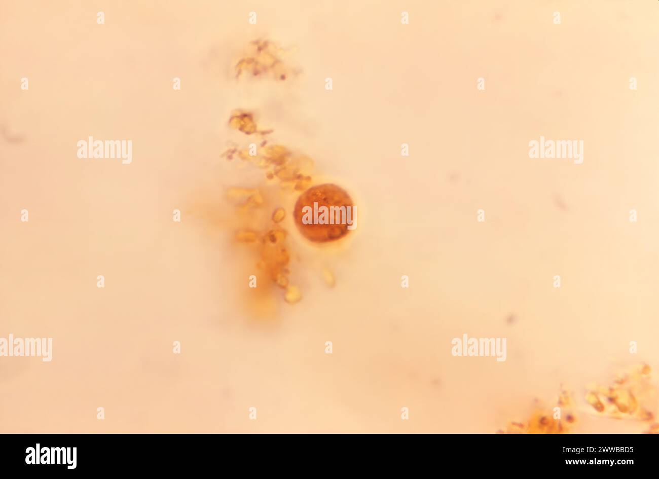 Under 1187.5X magnification, this photomicrograph of a trichrome ...