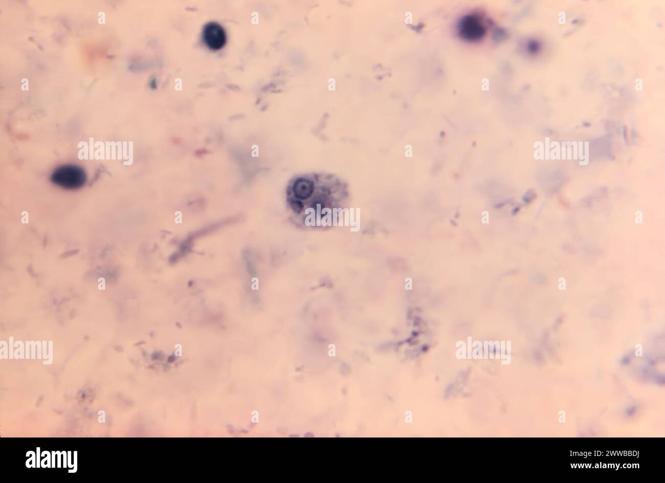 Under 1187.5X magnification, this photomicrograph of a trichrome ...
