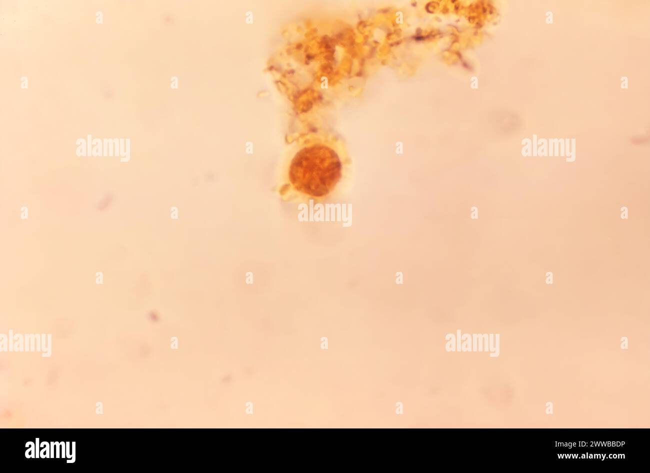 Under 1187.5X magnification, this photomicrograph of a trichrome ...