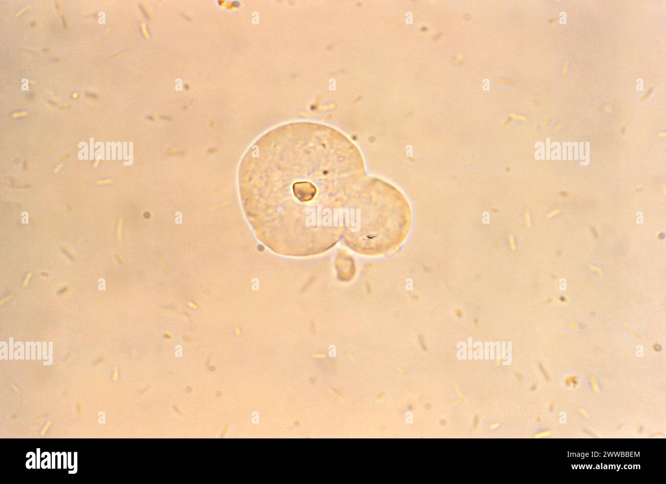 This photomicrograph was created from an unstained culture specimen and revealed the presence of ...