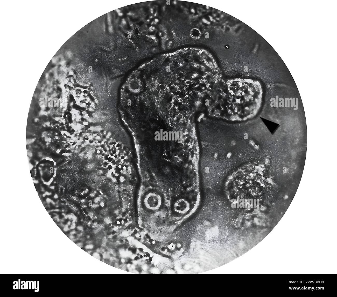 This photomicrograph of a living Entamoeba histolytica parasitic trophozoite reveals the method ...