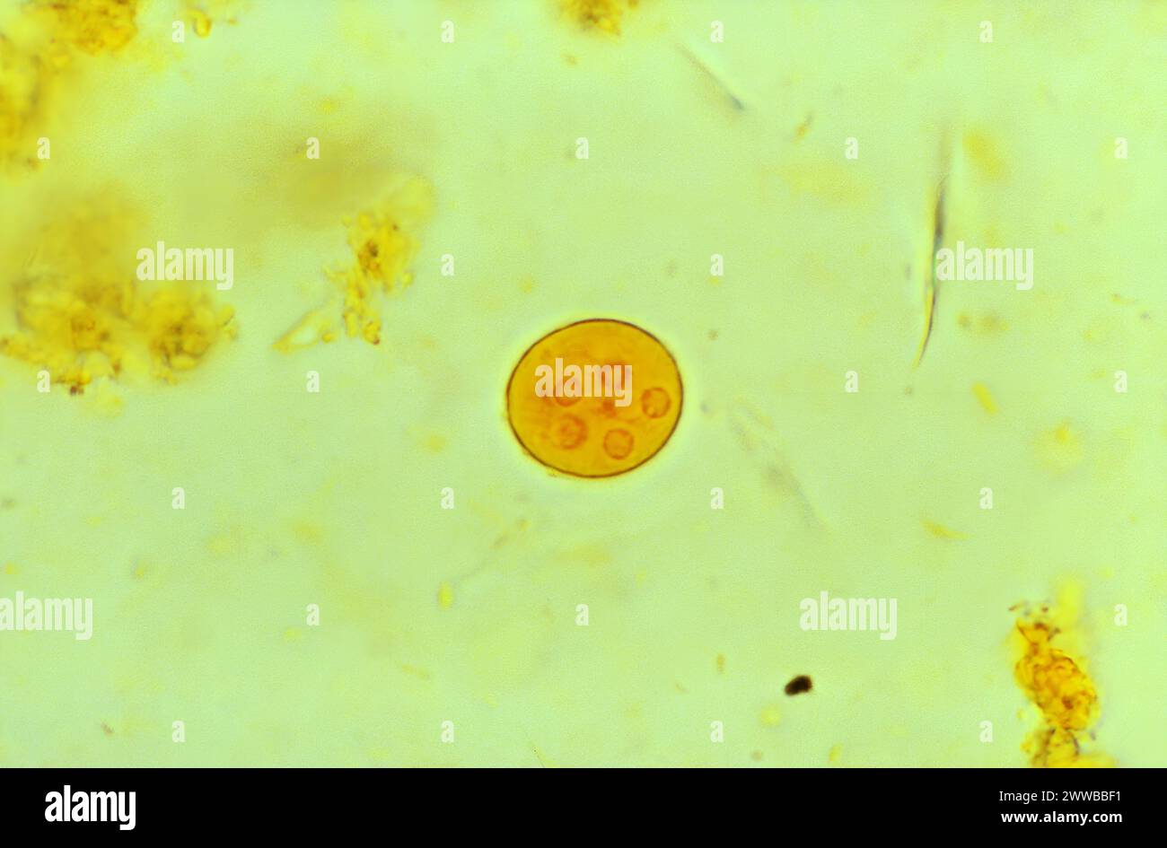 This photomicrograph of an iodine-stained specimen revealed the ...