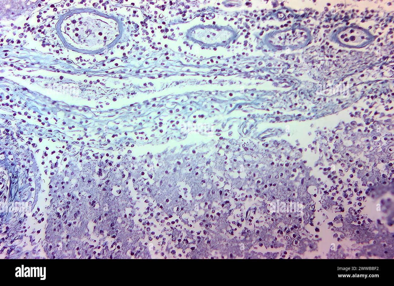 Under a magnification of 125X, this photomicrograph of a trichrome ... Under a magnification of 125X, this photomicrograph of a trichrome ...