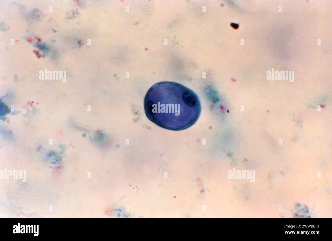 This photomicrograph of a trichrome-stained specimen revealed an ...