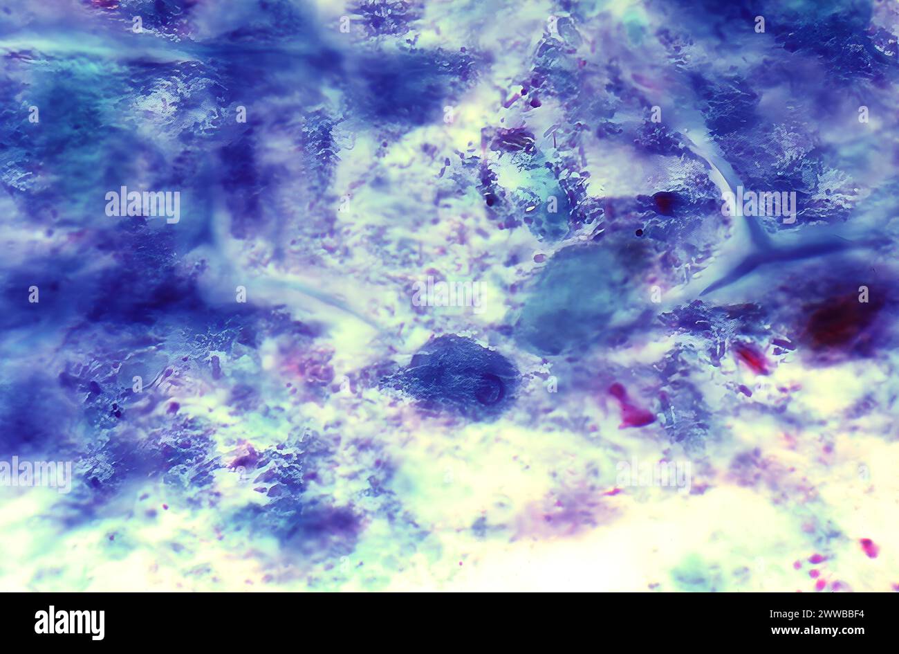 Entamoeba anatomy hi-res stock photography and images - Alamy