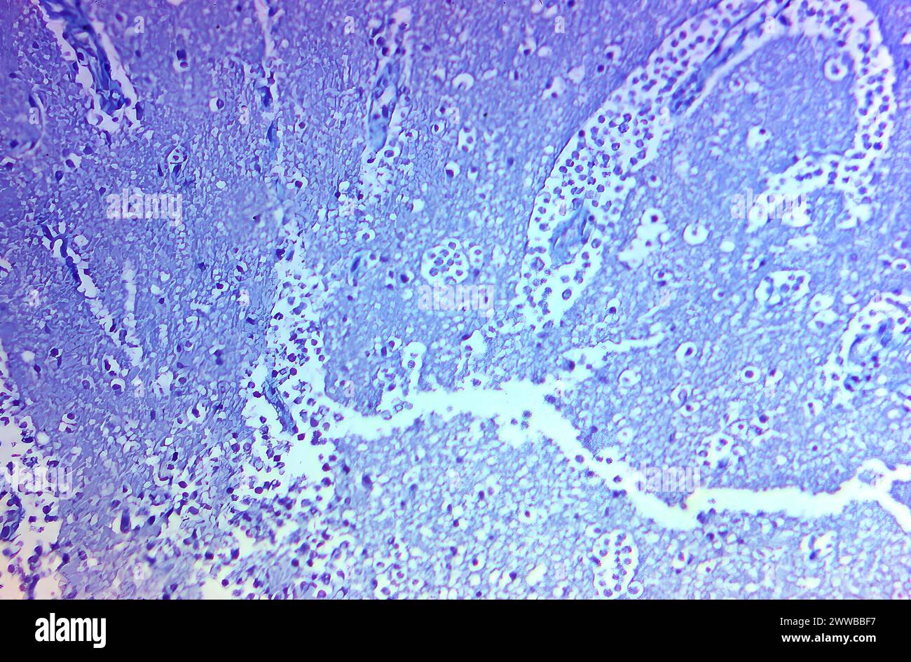 Under a magnification of 125X, this photomicrograph of a trichrome ...