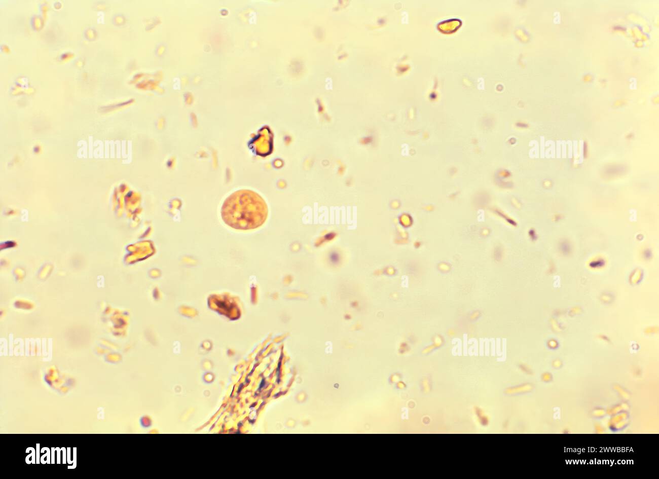 This photomicrograph of an iodine-stained specimen revealed an ...