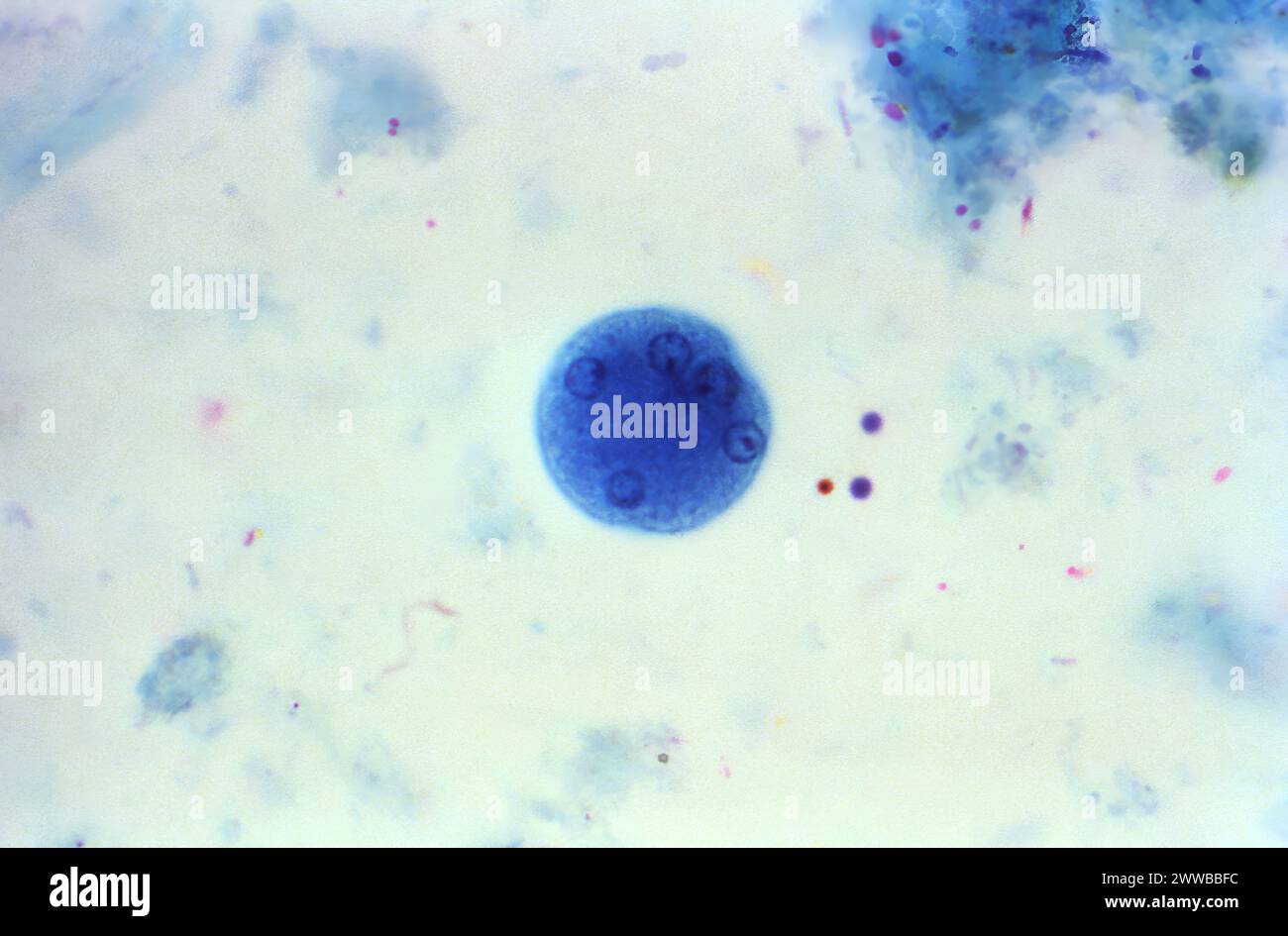 This photomicrograph of a trichrome-stained specimen revealed the ...