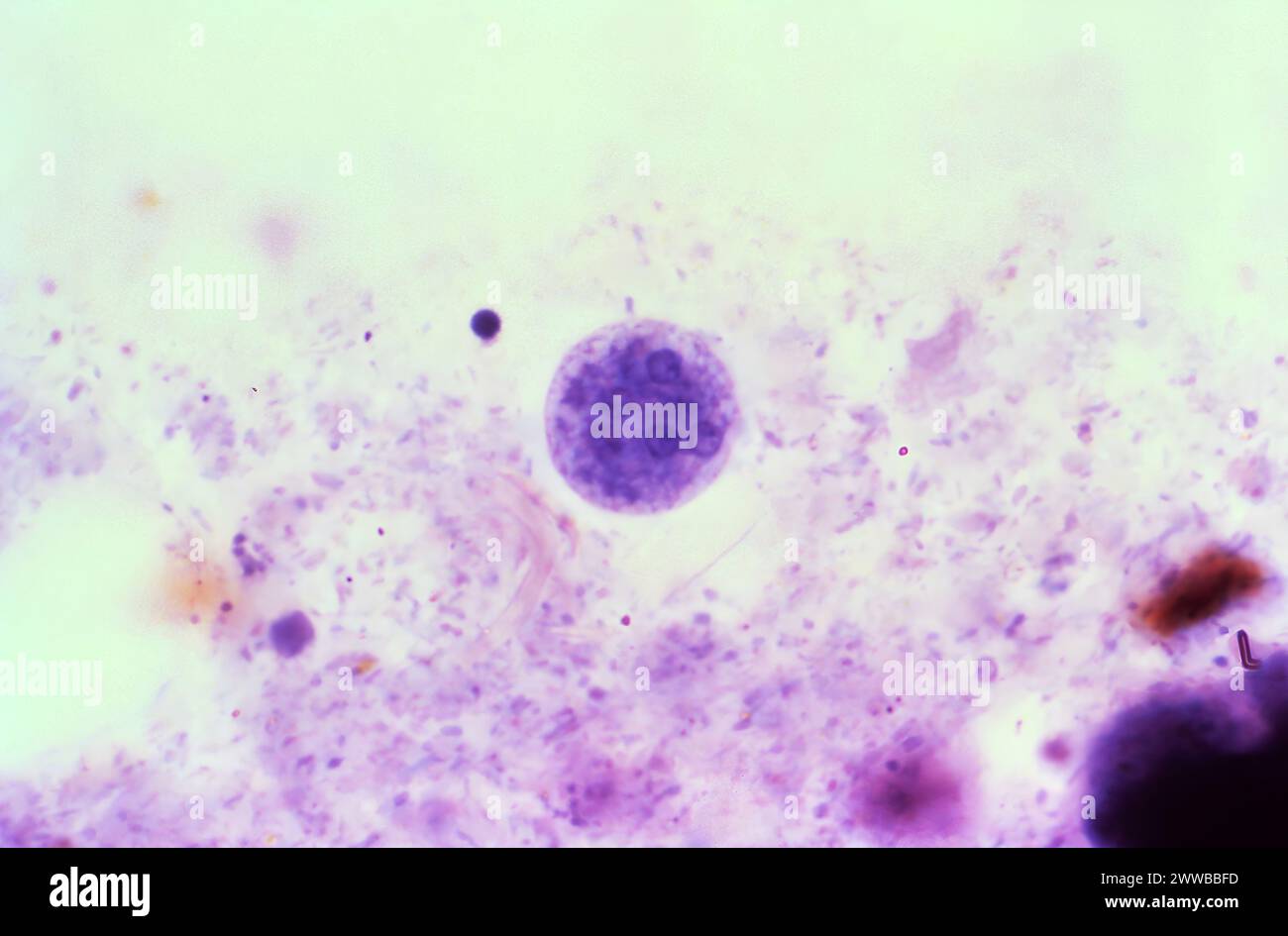 This photomicrograph of an iron-hematoxylin stained specimen revealed ...