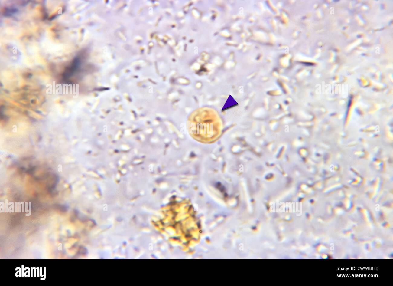 Under 1150X magnification, this photomicrograph of an iodine-stained ...