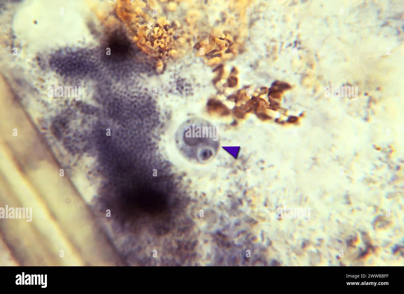 Under 1150X magnification, this photomicrograph of an iron-hematoxylin ...