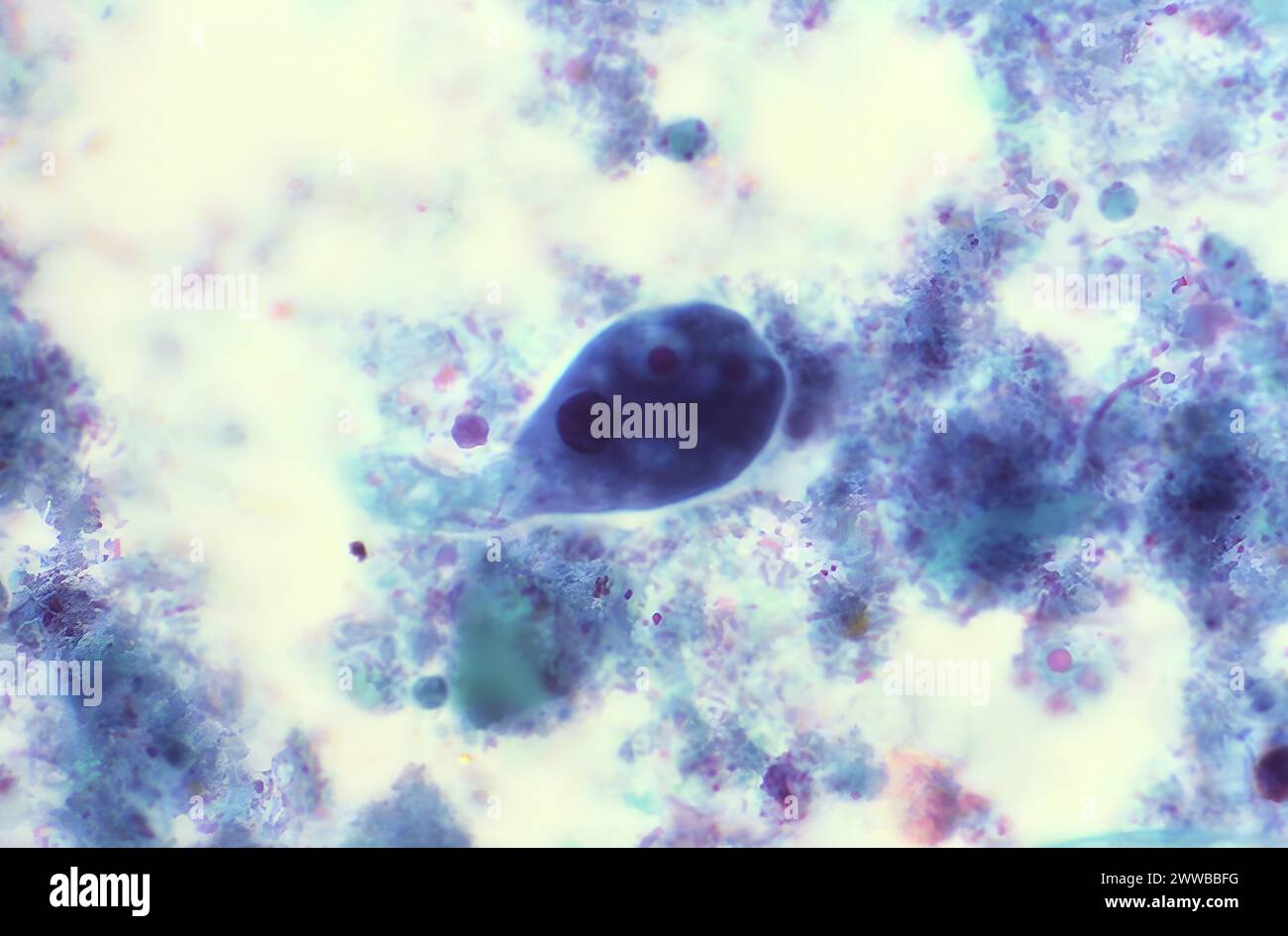 Entamoeba coli hi-res stock photography and images - Alamy