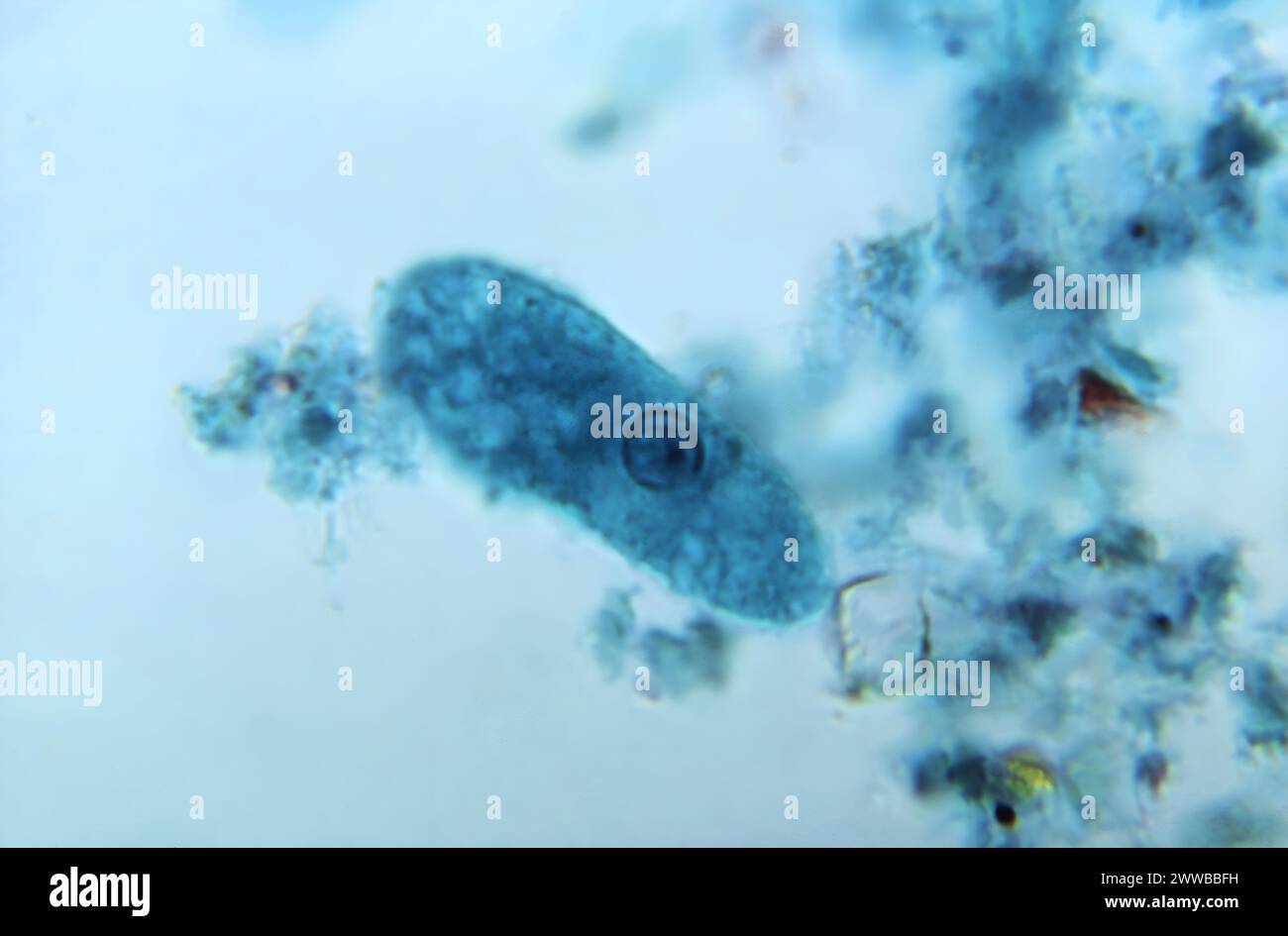 Entamoeba coli hi-res stock photography and images - Alamy