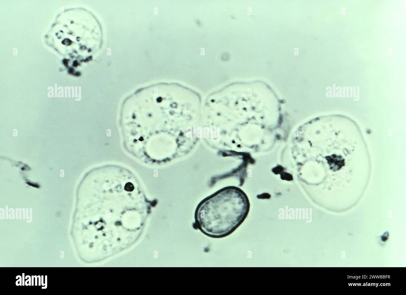 This photomicrograph of a methylene-blue, wet mounted fibroblast cell ...