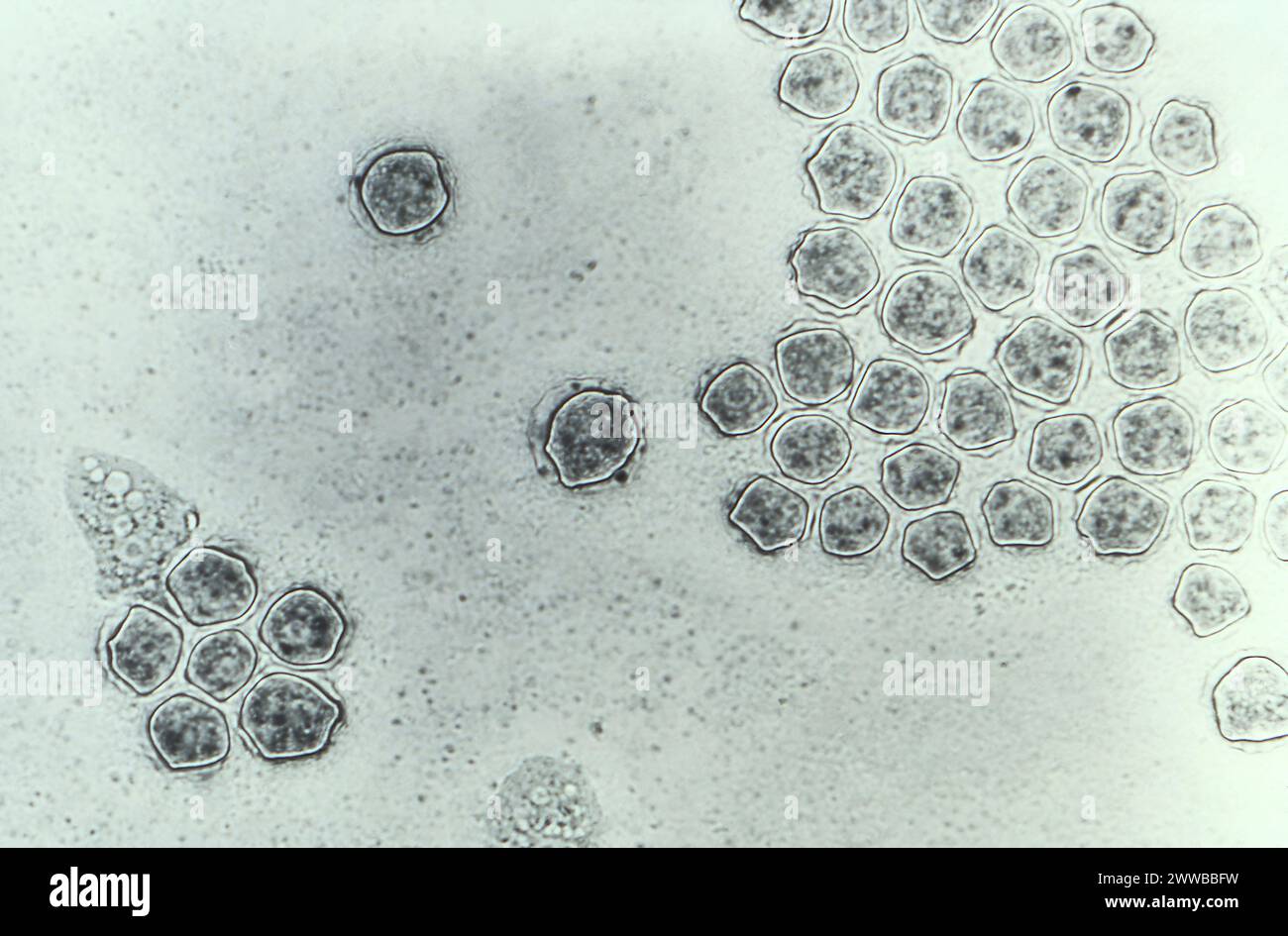 Obtained from an eye specimen taken from a patient in Thailand, who had ...