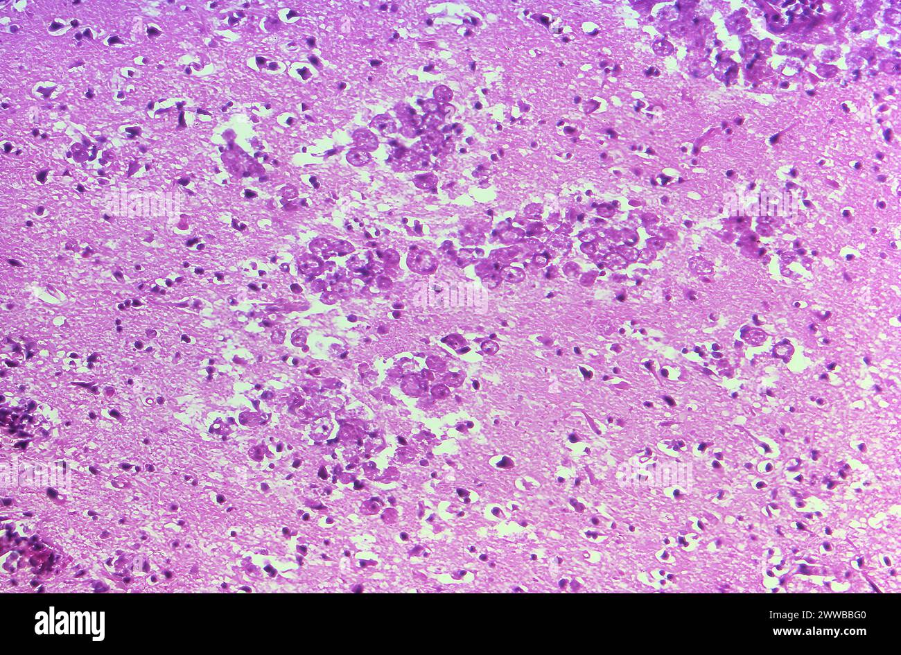 Histopathological hi-res stock photography and images - Alamy
