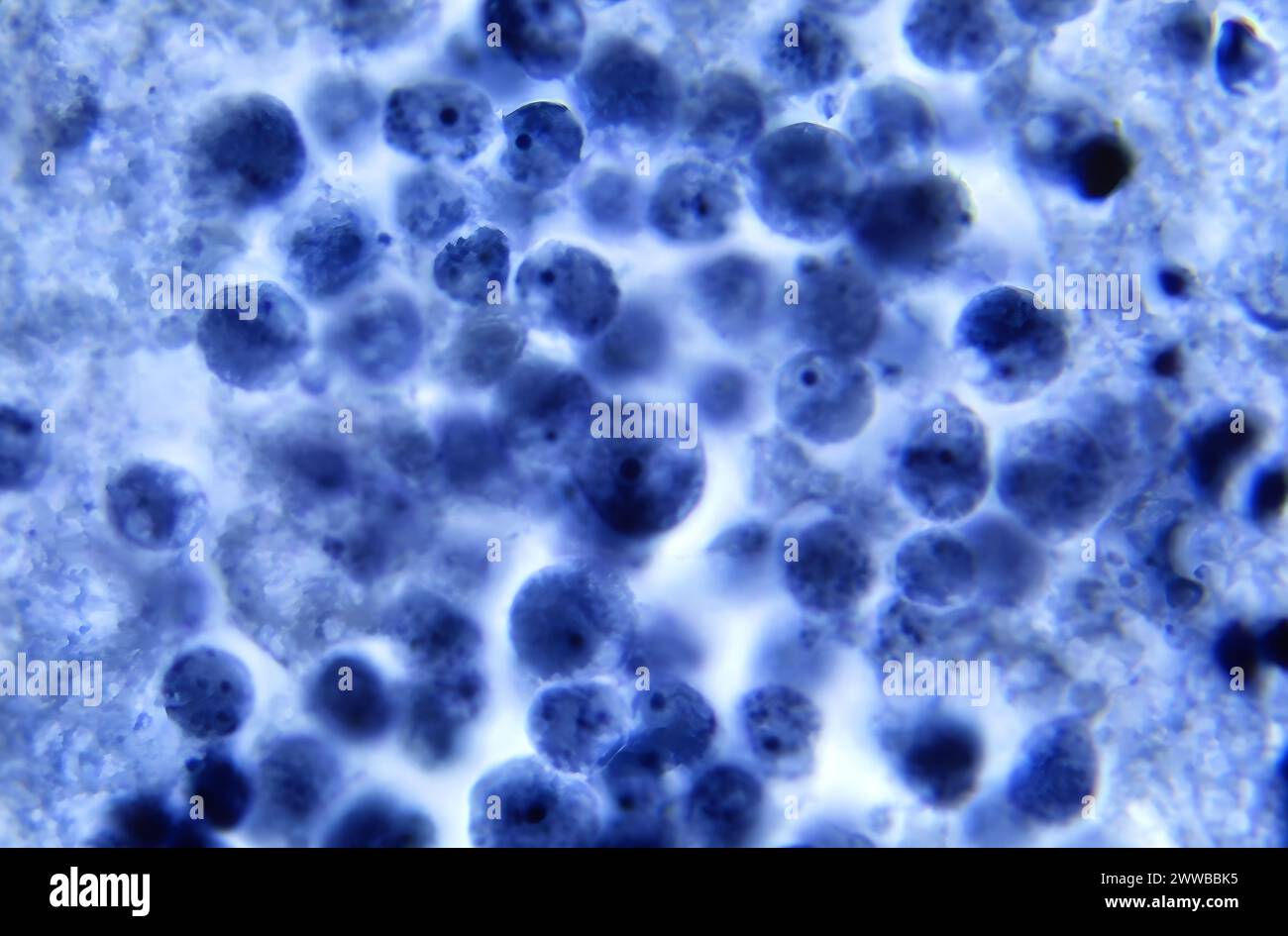 Under a magnification of 1250X, this photomicrograph of an iron ... Under a magnification of 1250X, this photomicrograph of an iron ...