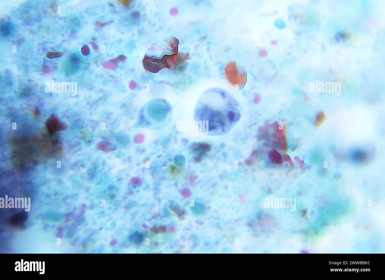 This photomicrograph of a trichrome-stained stool specimen revealed the ...