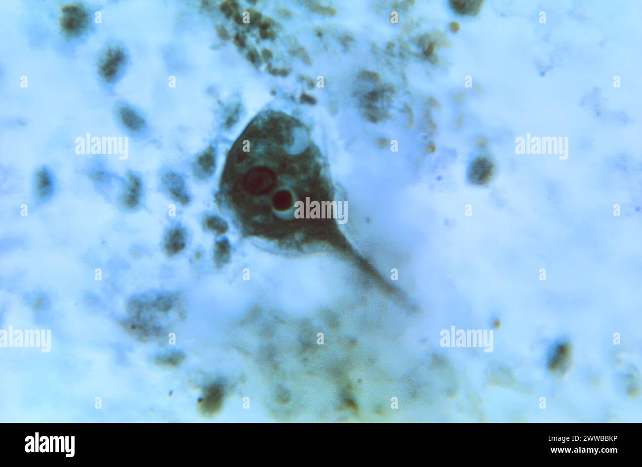 Under 900X magnification, this photomicrograph revealed the presence of a trophozoite of the ...