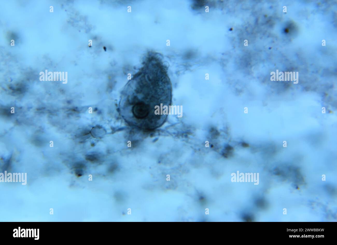 Under 900X magnification, this photomicrograph revealed the presence of ...