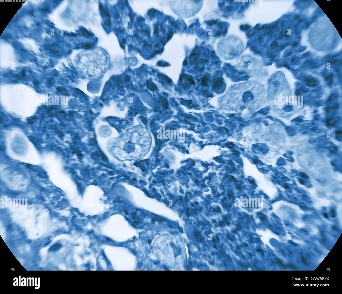 Under 900X magnification, this photomicrograph revealed the presence of ...
