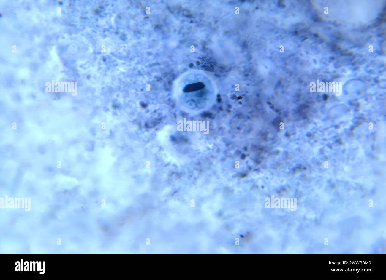 Under 900X magnification, this photomicrograph revealed the presence of ...