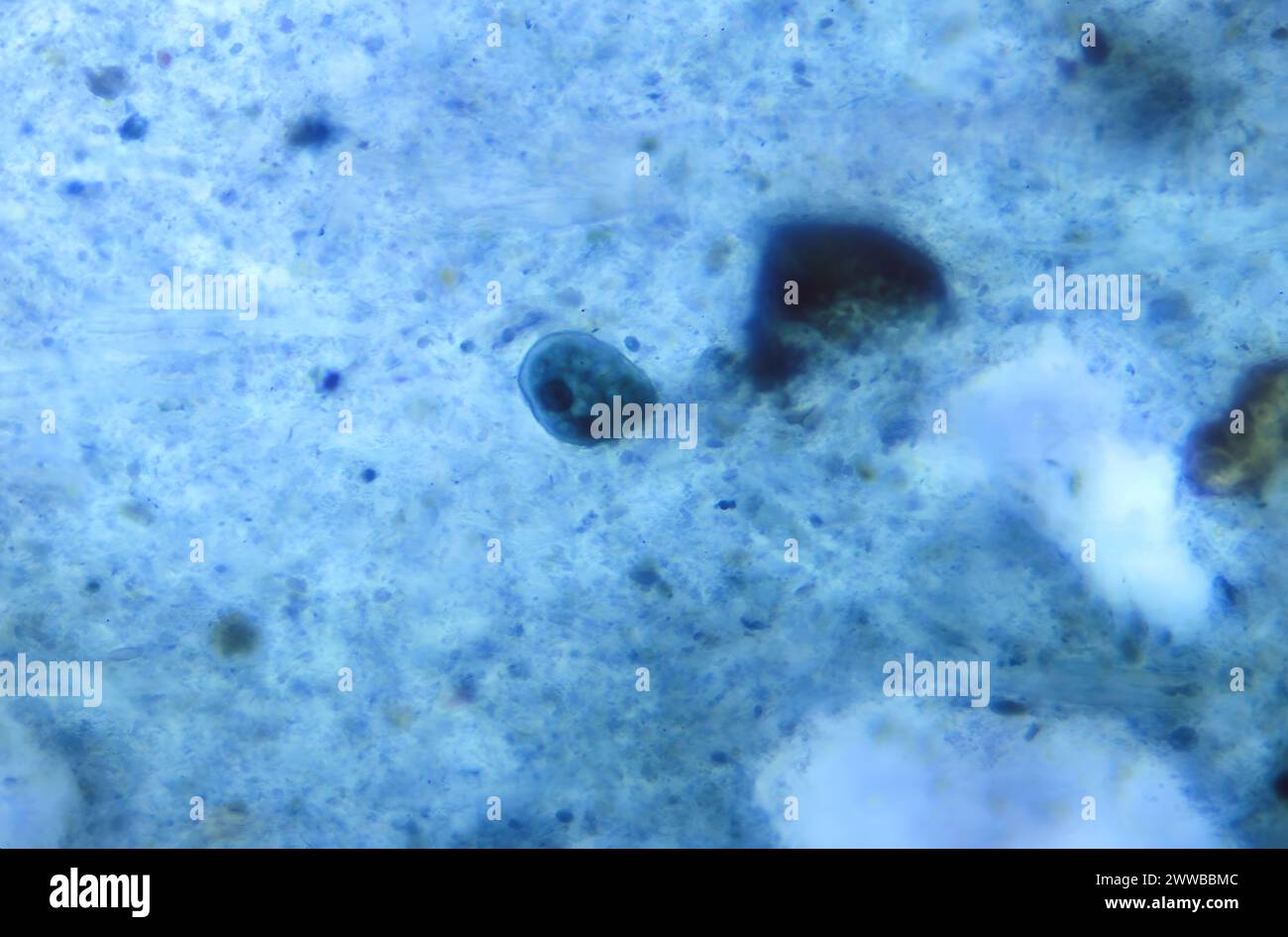 Under 900X magnification, this photomicrograph revealed the presence of ...