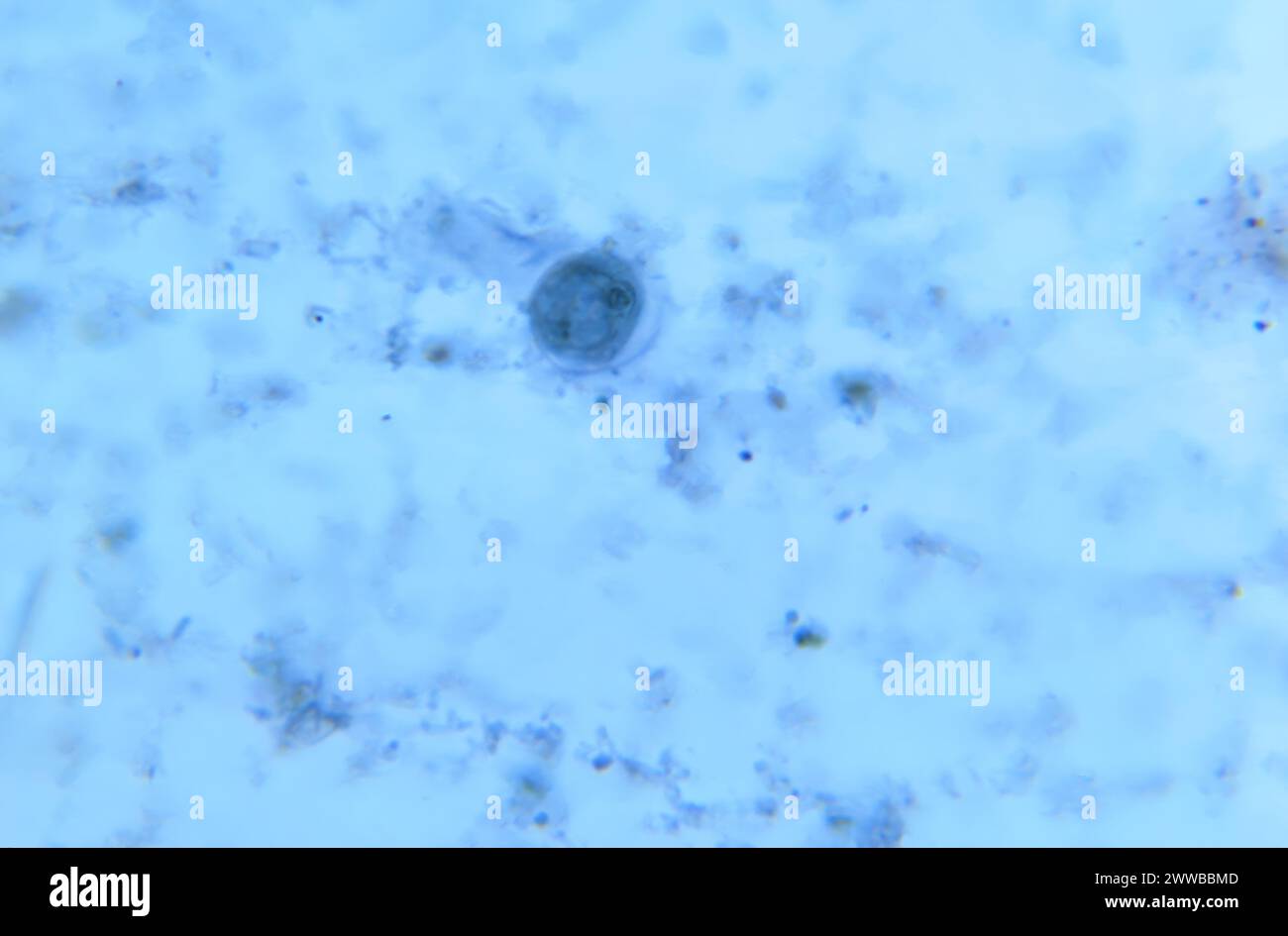 Dientamoeba fragilis hi-res stock photography and images - Alamy