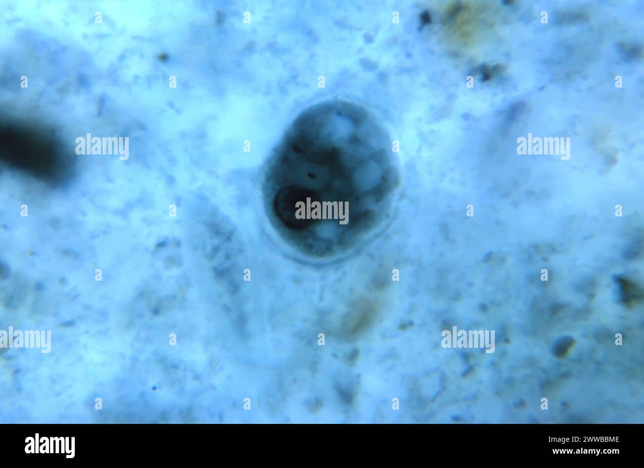 Entamoeba coli hi-res stock photography and images - Alamy