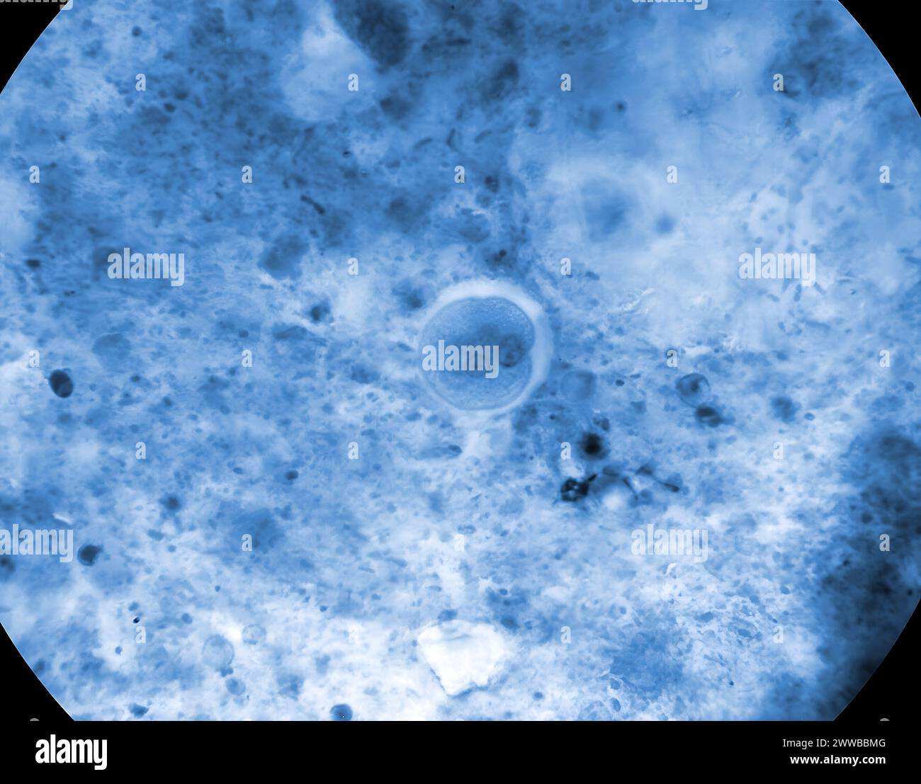 Under 900X magnification, this photomicrograph revealed the presence of ...