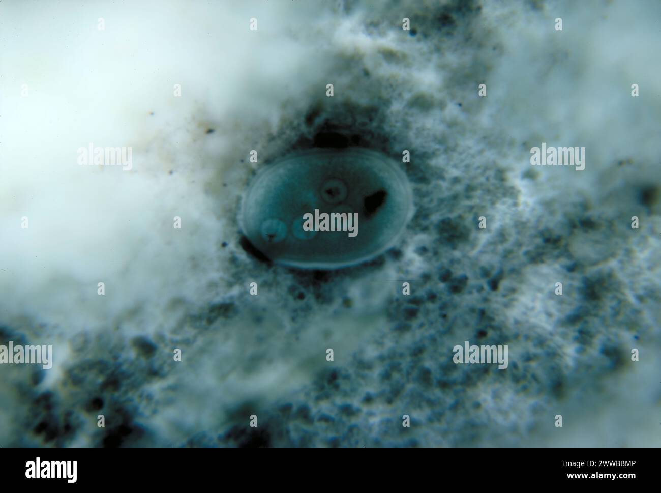 Under 900X magnification, this photomicrograph of a specimen stained ...