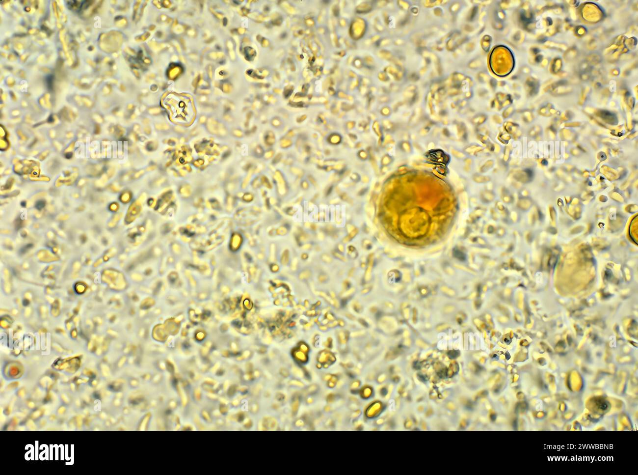 This iodine-stained photomicrograph depicts an amoebic parasite ...