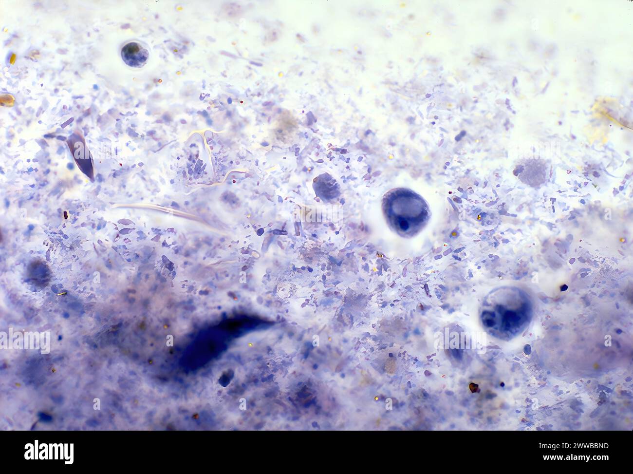 This photomicrograph shows a number of cysts of the amoebic parasite ...