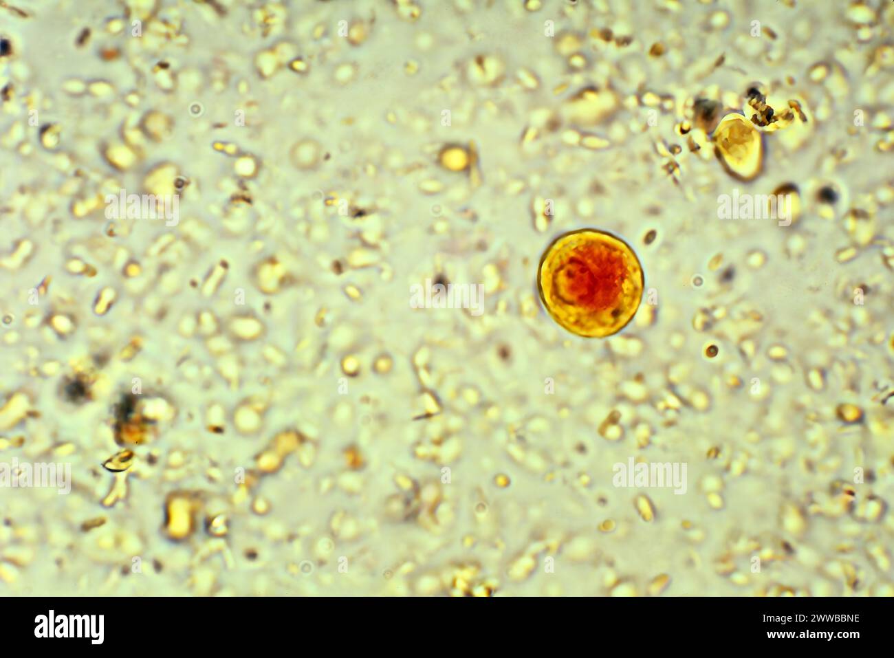 This iodine-stained photomicrograph depicts a mononuclear cyst of an ...