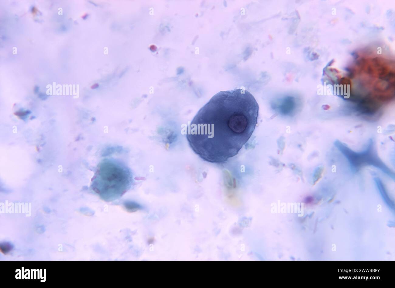 Parasitic amoeba entamoeba coli hi-res stock photography and images - Alamy