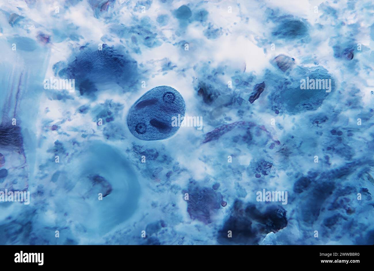 This photomicrograph reveals some of the ultrastructural details exhibited by a parasitic ...