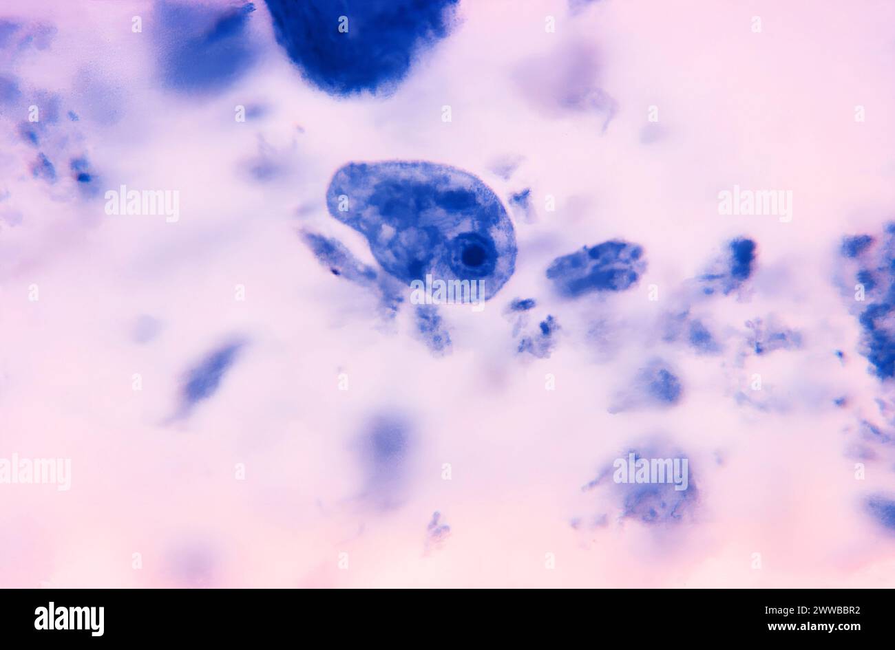 This photomicrograph reveals some of the ultrastructural details ...