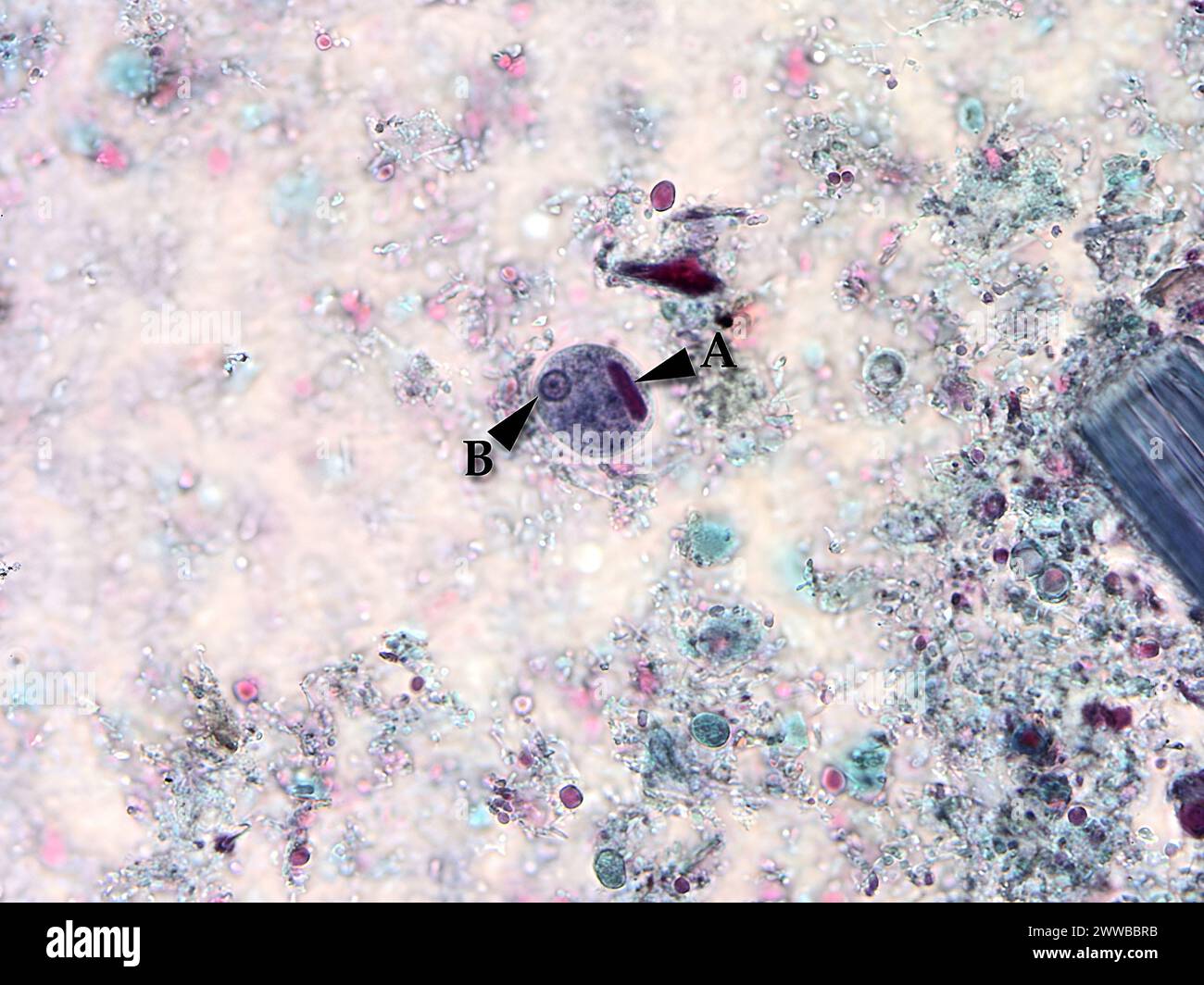 Using trichrome staining, this photomicrograph depicts a cyst of the ...