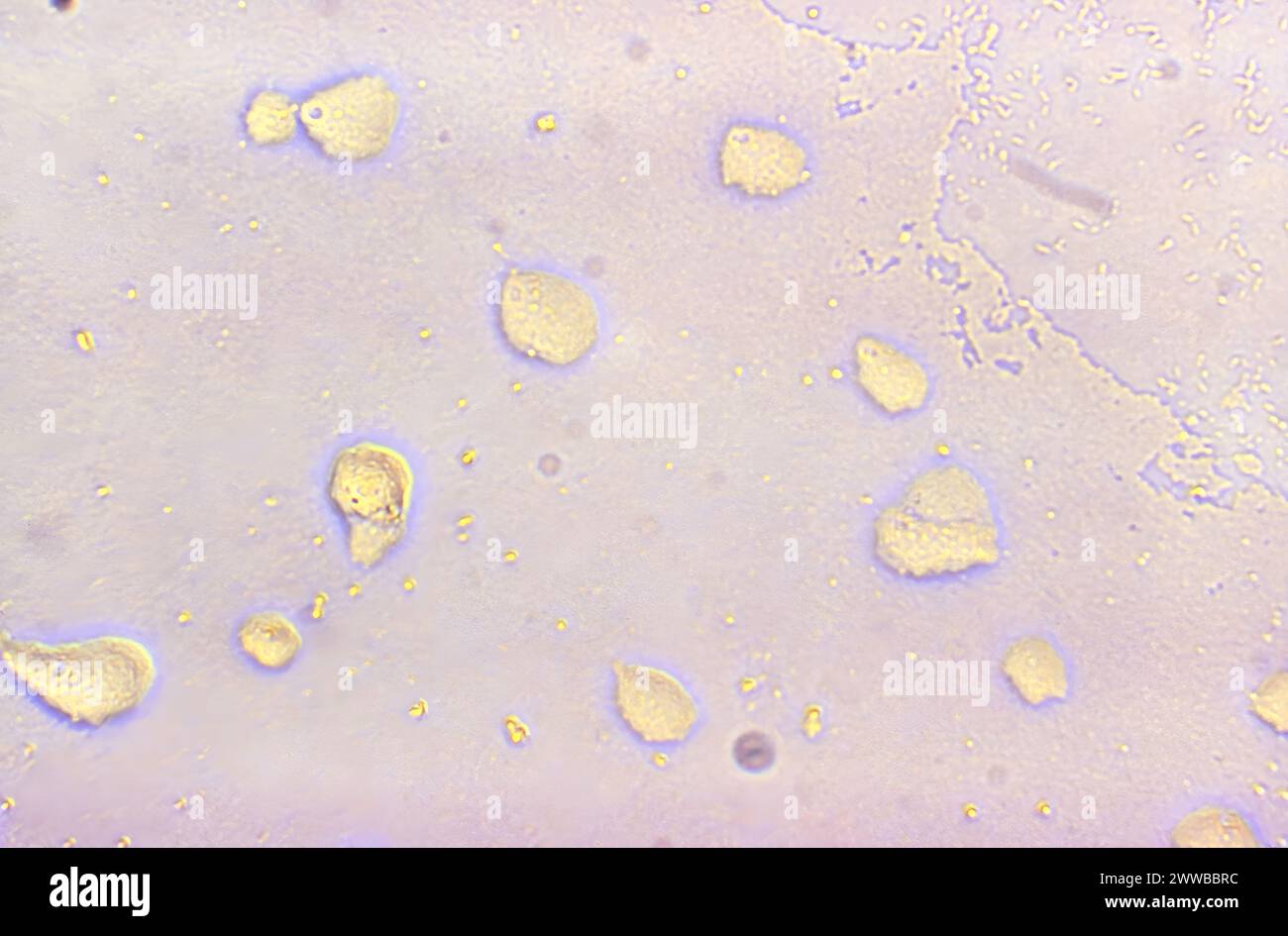 Medium magnification photomicrograph hi-res stock photography and ...
