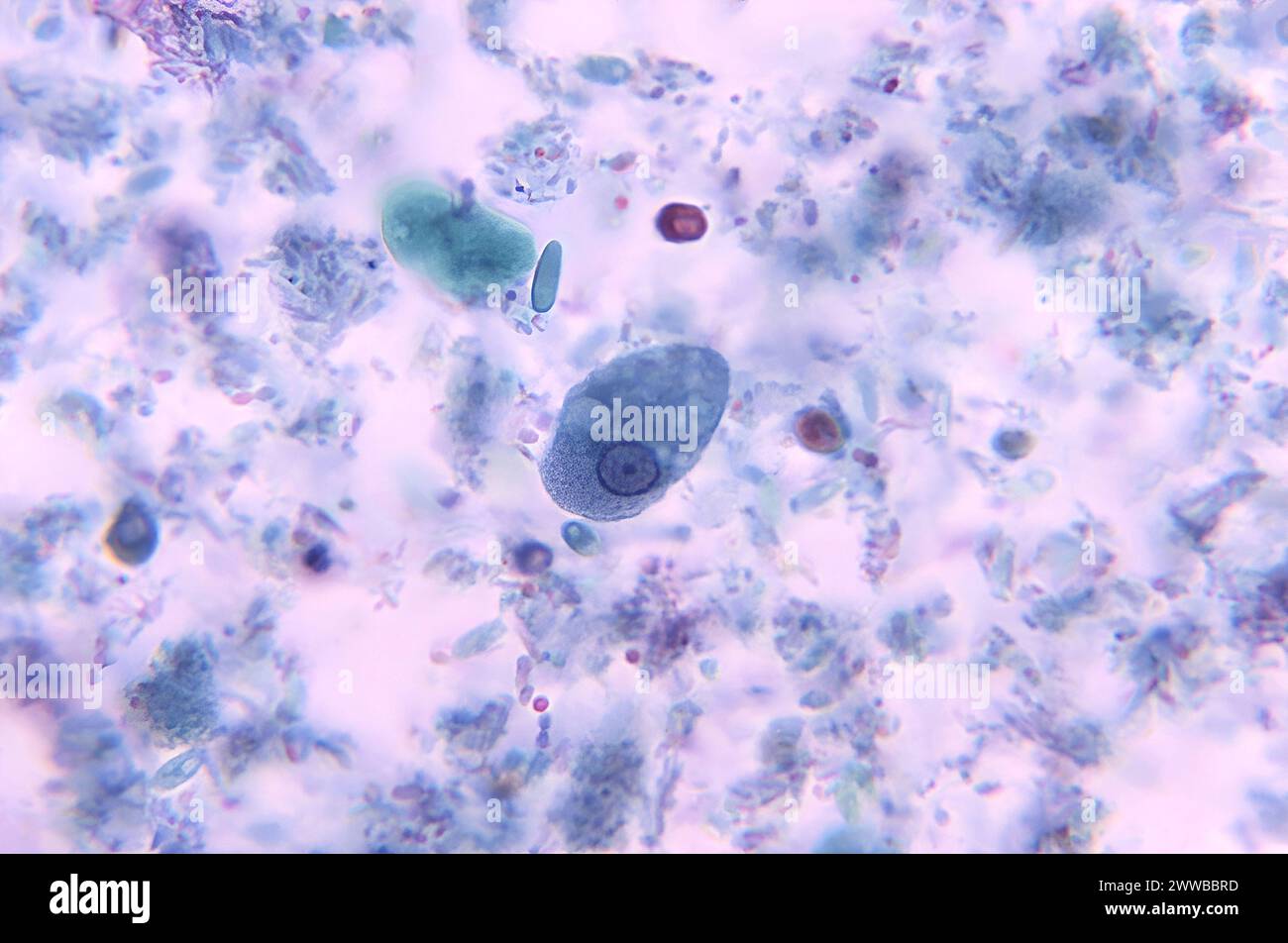Magnified 1125X, this photomicrograph revealed the presence of a parasitic trophozoite Entamoeba ...