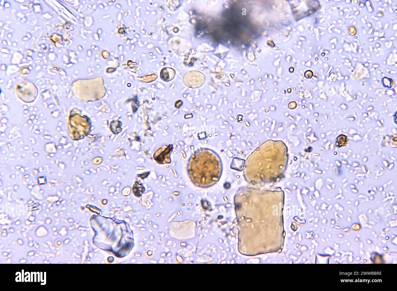Under 500X magnification, this photomicrograph of a concentrated Stock ...