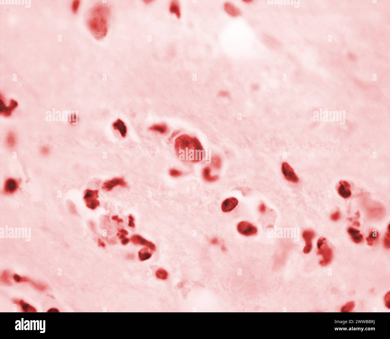 Under 1200X magnification Stock Photo - Alamy Under 1200X magnification Stock Photo - Alamy