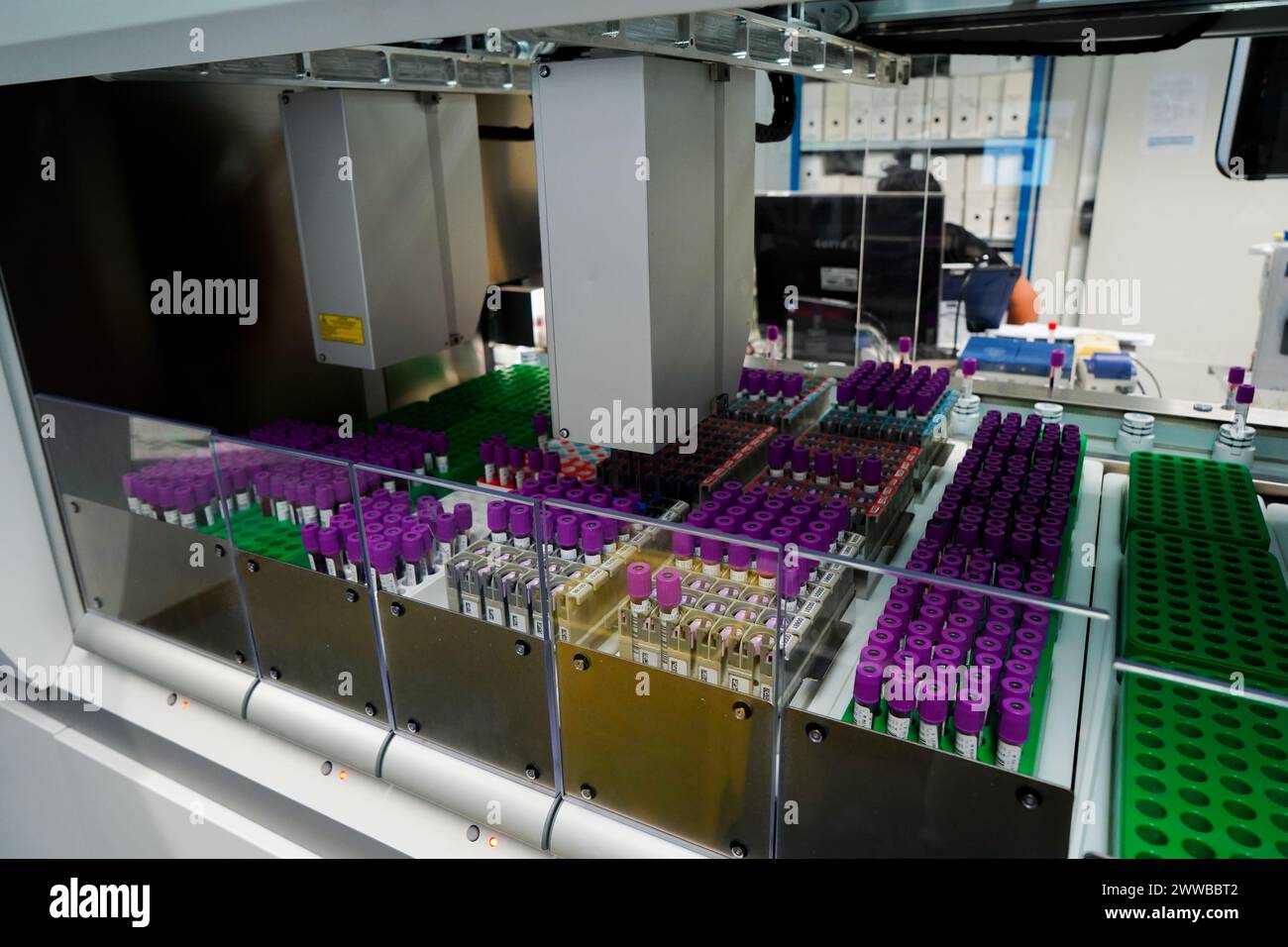 Technical platform of the Inovie 34 laboratory . Hematology tube sorter. NFS, blood count, VS ...